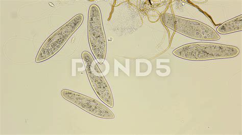 Paramecium Under Microscope Labeled All For One