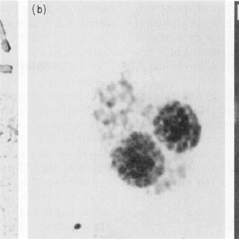 Aa Diploid A Silver Staining H Silver Stained Nucleus With Two Download Scientific