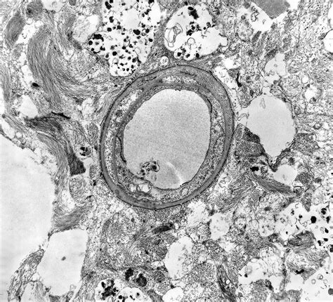 What Is Transmission Electron Microscopy Artofit