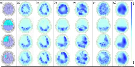 Imaging Results Of Simulation Experiments And The Snr Of Eit Data Is 40