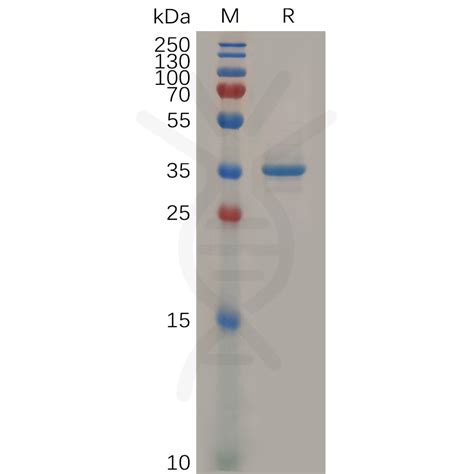 Buy Human Gpc3 Protein Hfc Tag Gpc3 Recombinant Protein Dima Biotech