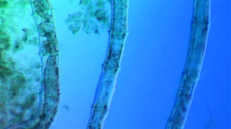 1152 Microscopic Worm Stock Videos Footage And 4k Video Clips Getty