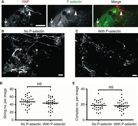 P Selectin Is Not Required For Von Willebrand Factor Vwf String Download Scientific Diagram