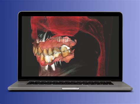 Software Per Progettazione Impianti Dentali Exocad Newtom