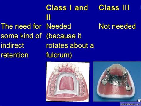 Lec 2principles And Essential Of Rpd Design Pptx درضوان Muhadharaty Lec 2principles And Essential Of Rpd Design Pptx درضوان Muhadharaty