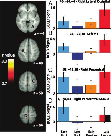 Group Differences Of Motor Preparation—interaction Between Increasing