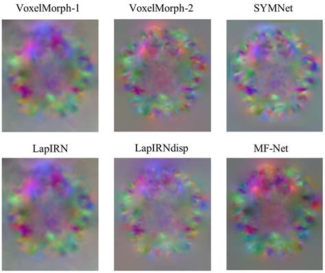 Frontiers Mf Net Multi Scale Feature Extraction Integration Network For Unsupervised