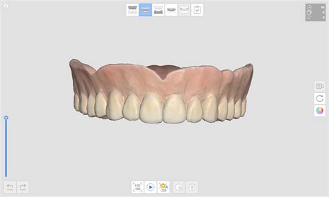 Denture Scan Medit Help Center