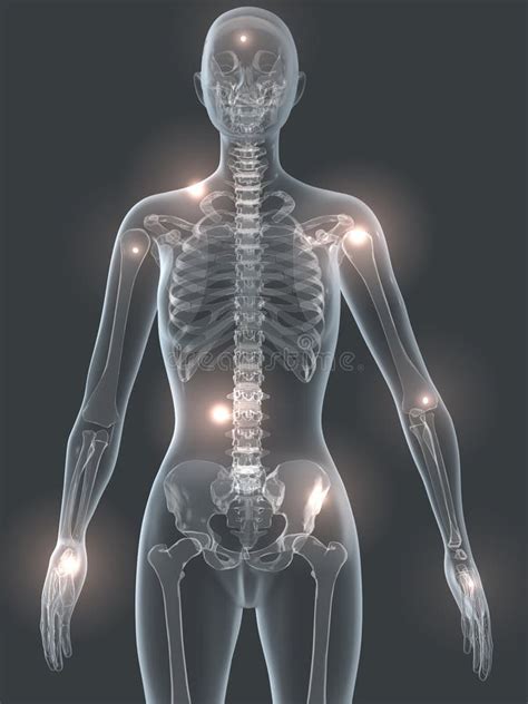 Triggerpoints Stock Illustration Illustration Of Triggerpoints 42755662