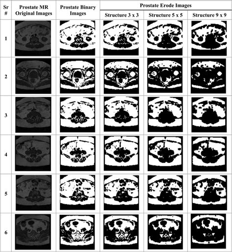 Morphological Operation With Different Size Of Structuring Elements Download Scientific Diagram
