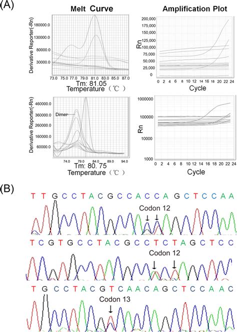 The Feasibility Was Tested For 7 Hotspot Mutations Detecting Of Kras
