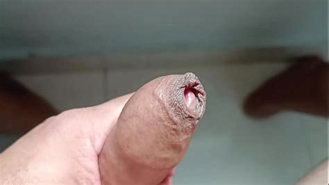 Removing The Foreskin 1 Xxx Mobile Porno Videos And Movies Iporntvnet