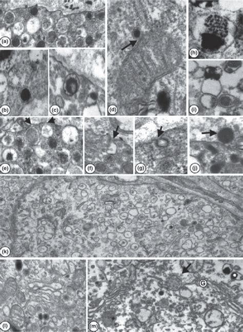 Chromaffin Cells Histology