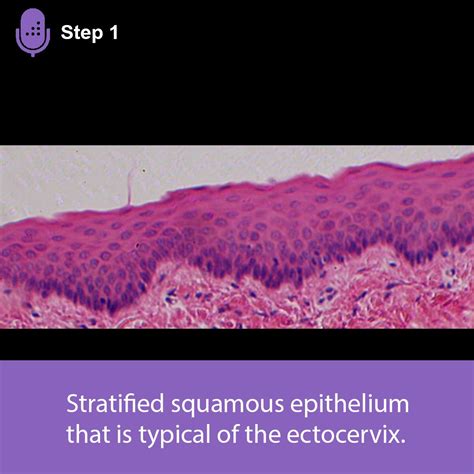 Stratified Columnar Epithelium