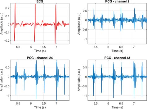 Figure 7 From A Wearable Multi Sensor Array Enables The Recording Of