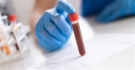 യുവാക്കളിൽ ഹീമോഗ്ലോബിൻ അളവ് ഉയരുന്നതായി പഠനം മനോരമ ഓൺലൈൻ ന്യൂസ്