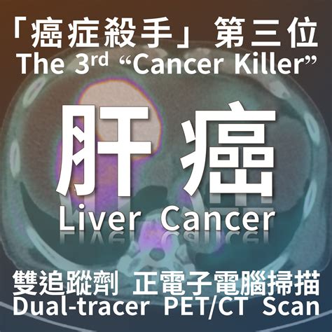 Advanced Imaging Technique For Hong Kongs Third “cancer Killer” Liver Cancer 聖德肋撒醫院 掃描部