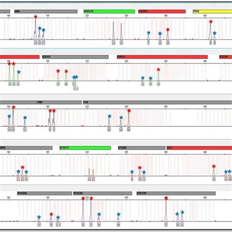 Electropherogram Of Y Str Profiling Of Female Male Mixture Obtained