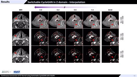 Continuous Conversion Of Ct Kernel Using Switchable Cyclegan With Adain