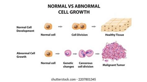 Normal Vs Abnormal Cell Growth Development Stock Vector Royalty Free