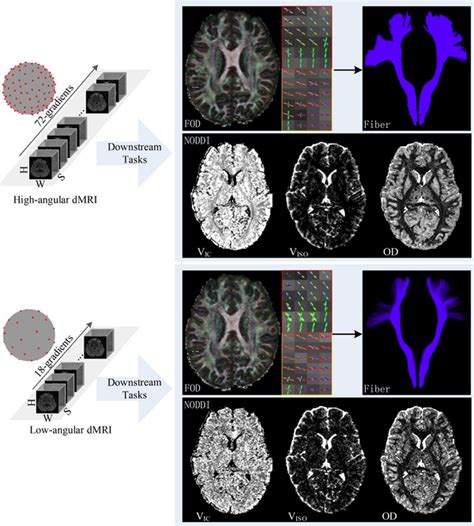 Illustration Of Ha Dmri Data 72‐gradients And La Dmri Data