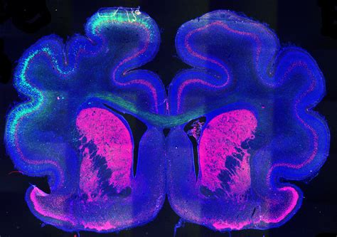 Cortex Cerebral