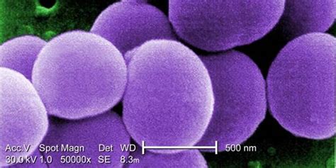 Increased Infections Noted With Longer Duration Neonatal PICC Placement 2 Minute Medicine