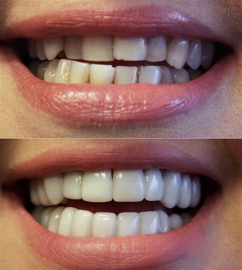 Best 12 Foot Pain Symptoms Causes And Treatment Artofit