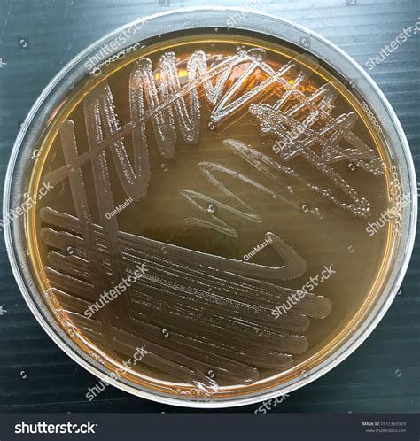 Proteus Vulgaris Macconkey Agar Guinea4 Work Plate Reading For