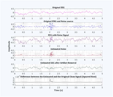 Understanding The Nonlinear Behavior Of Eeg With Advanced Machine Learning In Artifact