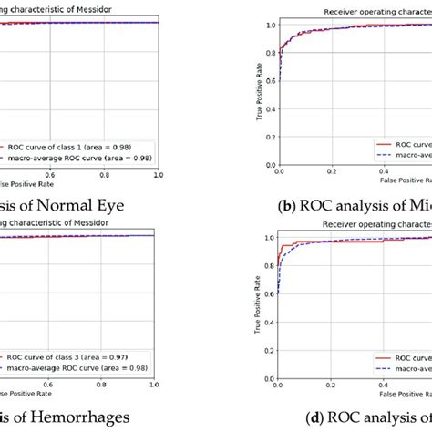Class Wise Performance Of The Messidor Dataset Download Scientific
