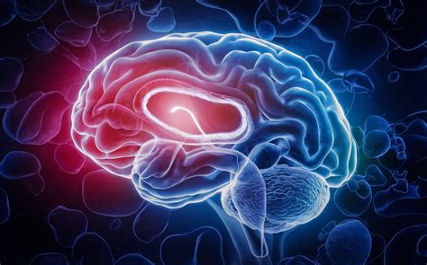 “choroid Plexus Carcinoma Understanding Symptoms Treatment And Prognosis”