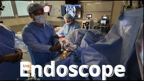 Endoscopic Microvascular Decompression At Douglas Jacobson Blog
