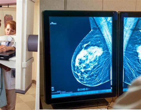 What To Expect When You Go For Your Mammogram