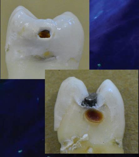 Operative Flashcards Quizlet