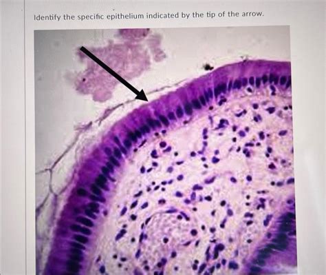 Solved Name The Epithelium Seen In The Image