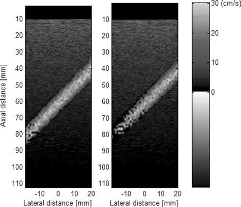 Plot Of The Symmetric Real And Imaginary Parts Of A 32 Tap Decoding Download Scientific Diagram