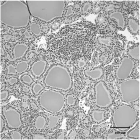 Thyroglobulin From Molecular And Cellular Biology To Clinical Endocrinology Pmc