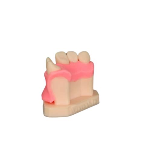 Buy Partial Extraction Technique V Invent Online At Lowest