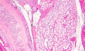 Arrayit Tissue Microarrays For Basic And Cancer Research Life Sciences Clinical And