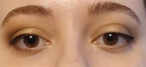 why do my eyes dilate so unevenly contact wearer r optometry