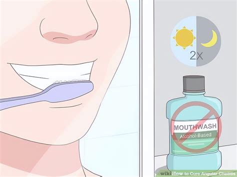 唇炎症状反复怎么治疗？唇炎自救指南快拿去 说明书网