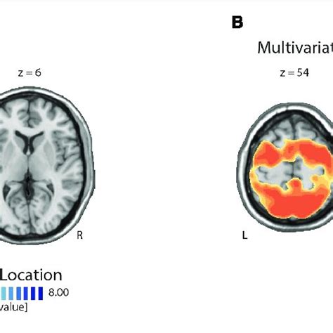 topographies of uni and multivariate fmri analysis results a the