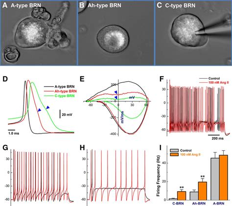 Unique Expression Of Angiotensin Type 2 Receptor In Sex Specific