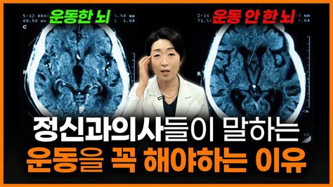운동을 안 하면 뇌가 망가진다” 평범한 사람이 꾸준히 운동했더니 생기는 놀라운 변화ㅣ이선화 정신과 의사 Youtube
