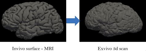 Exvivo Surface Mesh Reconstruction From In Vivo Freesurfer Meshes Sgi 2023