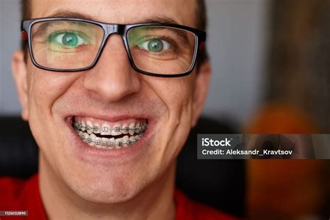 그의 미소와 안경에 중괄호와 남자의 미친 얼굴 행복 한 식입니다 남자의 초상화를 닫습니다 감정에 대한 스톡 사진 및 기타 이미지