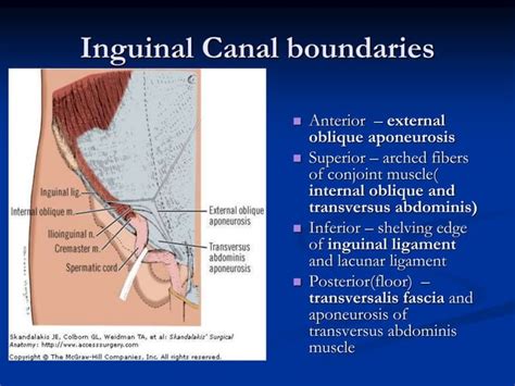 Basics Of Inguinal Hernias Ppt Death Injury Or Military Conflict