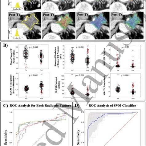 Pdp Effects After Light Treatment Are Seen With Texture Analysis A A