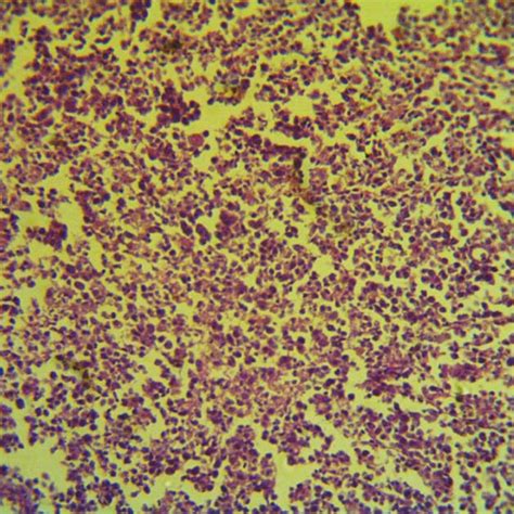 Biochemical Tests For Bacterial Identification Of Staphylococcus Aureus